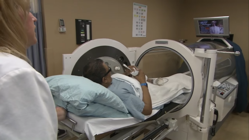 Hyperbaric Oxygen Therapy - What Doctors Recommend - 2024 Guide ...
